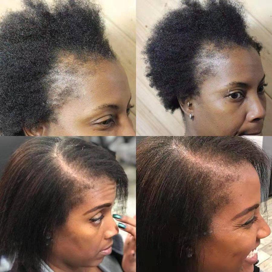 Wonder Scalp Stimulator Hair Growth Oil 2oz – Madani Naturals